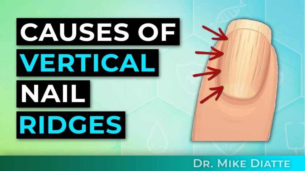 **Unlocking the Secrets Behind Vertical Nail Ridges** – History Archive